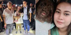 Tuah Missclyen kini anak angkat Raja Permaisuri Agong, alami penyakit ...